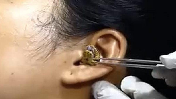 ಮಹಿಳೆಯ ಕಿವಿಯಲ್ಲಿ ಹಾವು: ಶಾಕಿಂಗ್ ವಿಡಿಯೋ ವೈರಲ್ | Snake in woman's ear ...